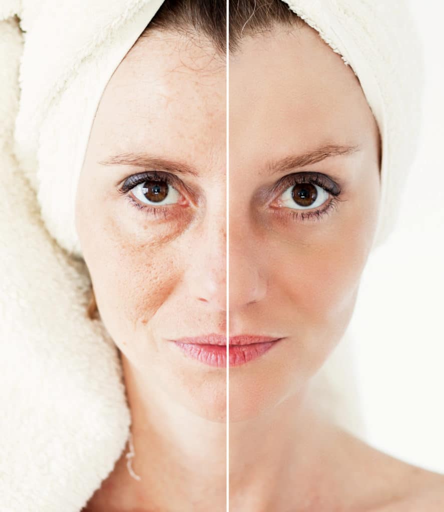 Younger Looking Skin | Short Hills Dermatology
