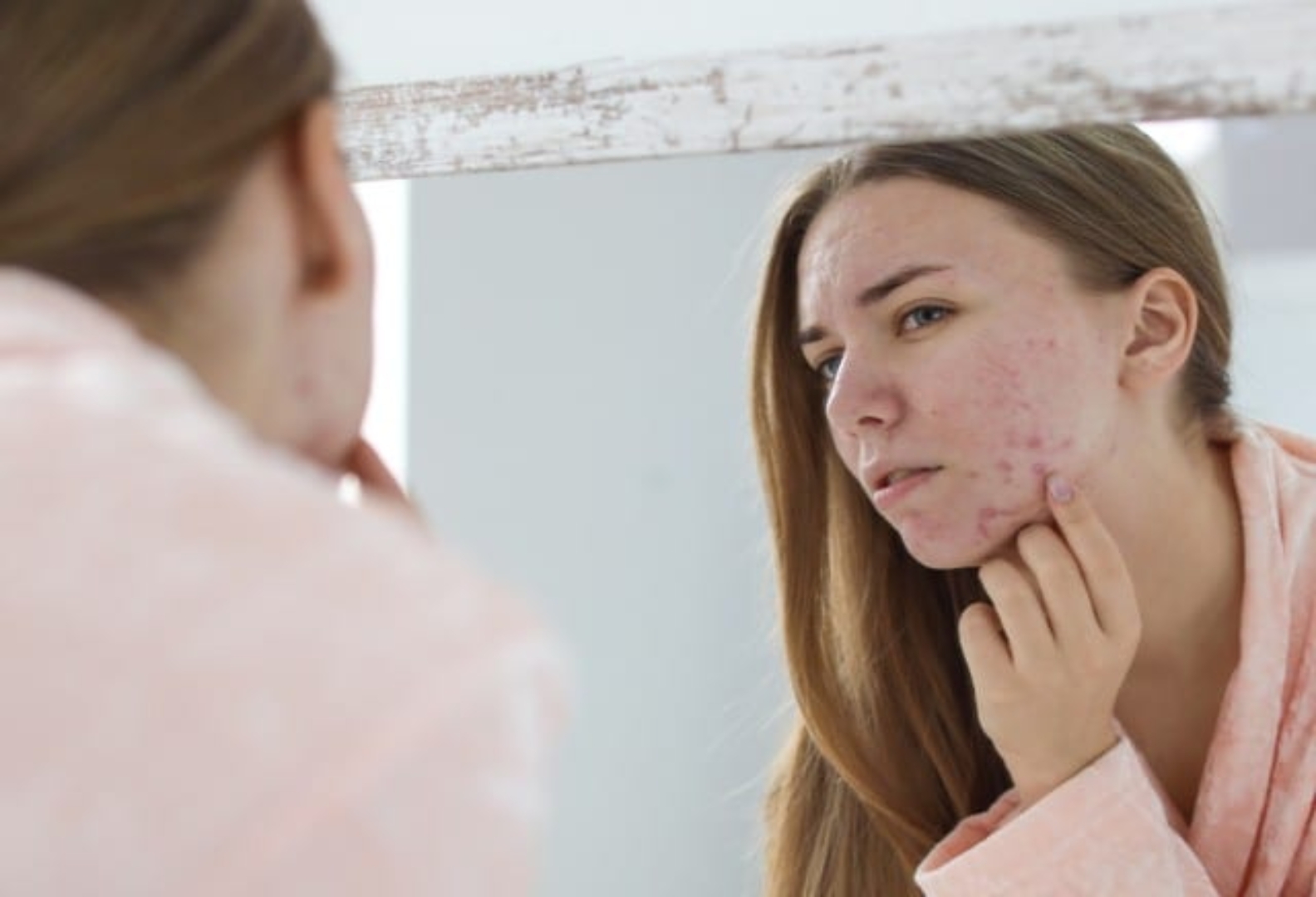 Four Signs You Need To See a Dermatologist for Your Acne - Short Hills ...