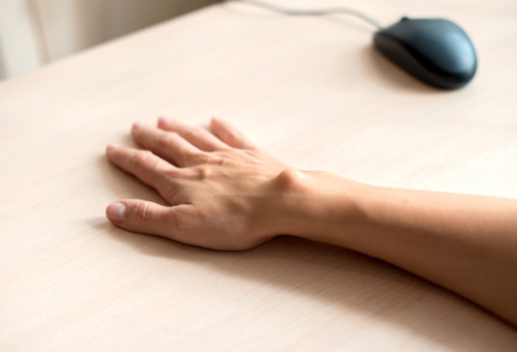 What is a lipoma? - Short Hills Dermatology